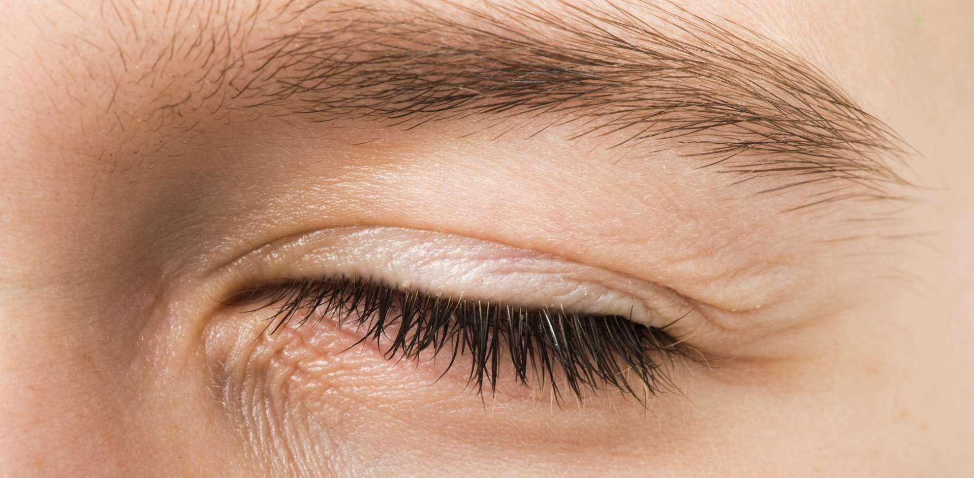 Eyelid Growths | Eye Clinic Surgicenter | Eyelid Surgery Billings - Eye ...