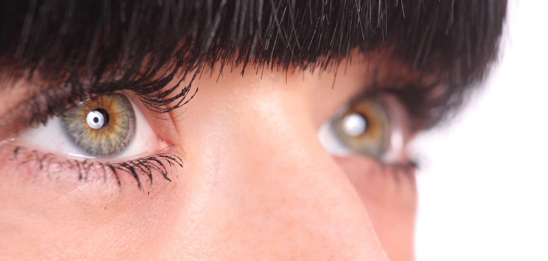 Abnormal Eyelashes | Eye Clinic Surgicenter | Eye Clinic Billings - Eye ... Abnormal Eyelashes | Eye Clinic Surgicenter | Eye Clinic Billings - Eye ...